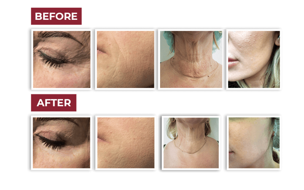 PLINEST | Ardence Pharma Sdn Bhd